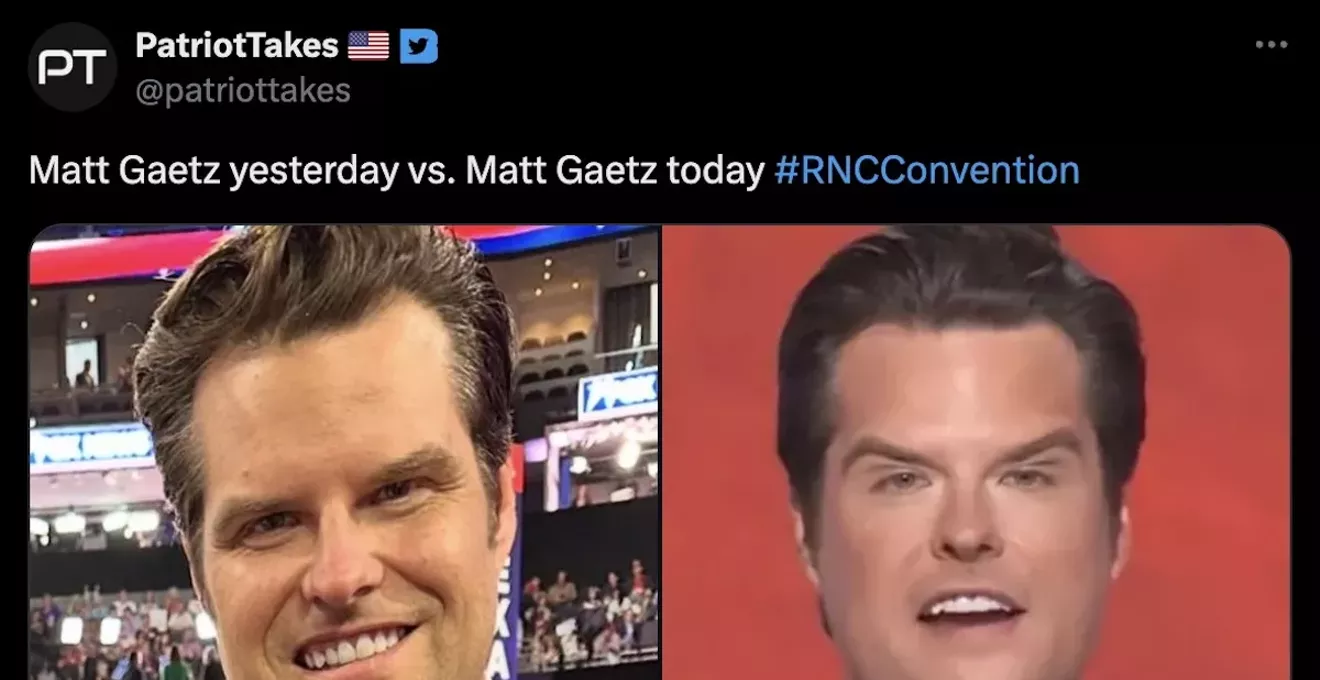 Dr. Miami Weighs In On Matt Gaetz’s Face, Plastic Surgery Rumors ...